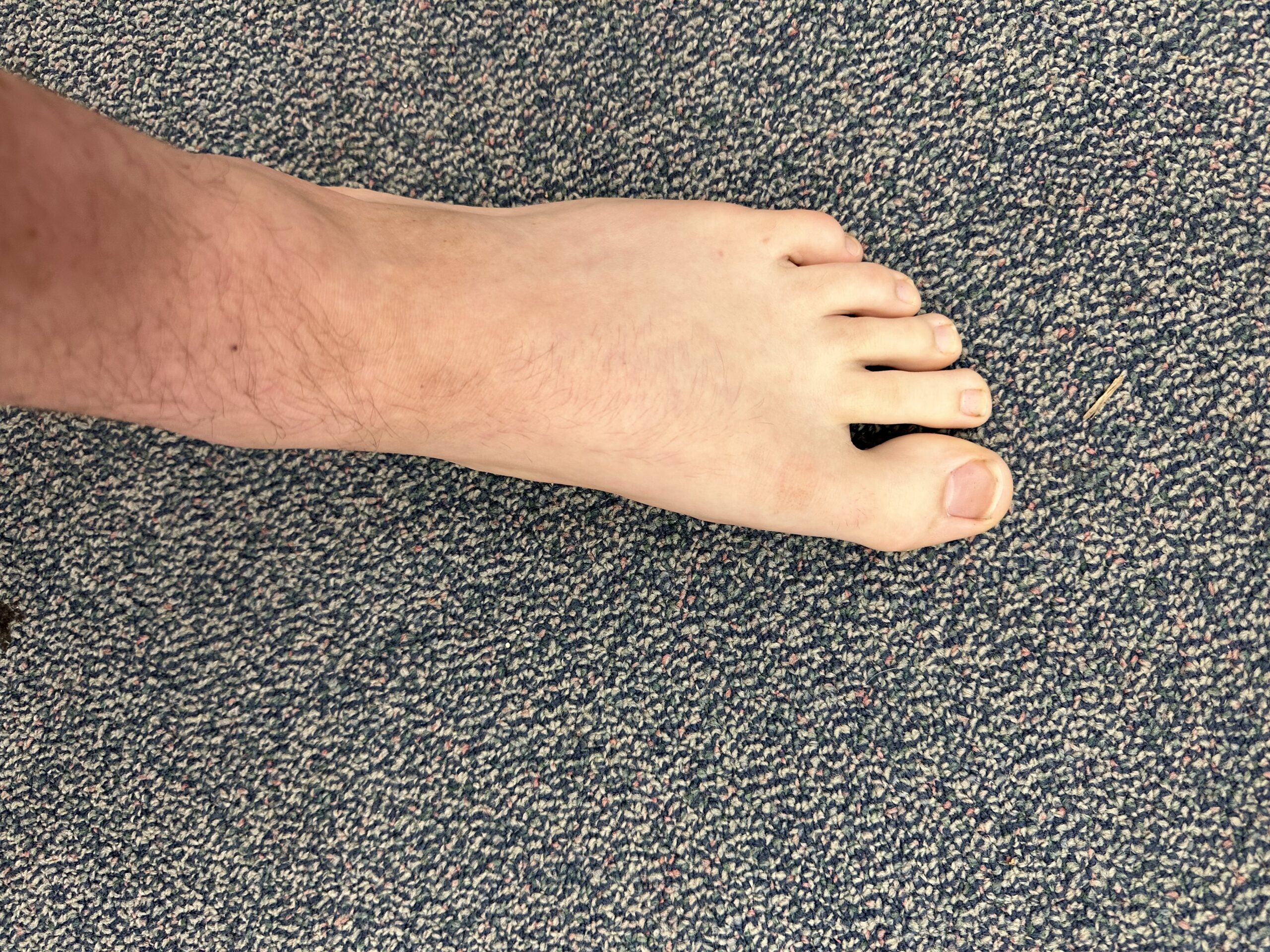 Teenage Male Toes Fun With Feet
